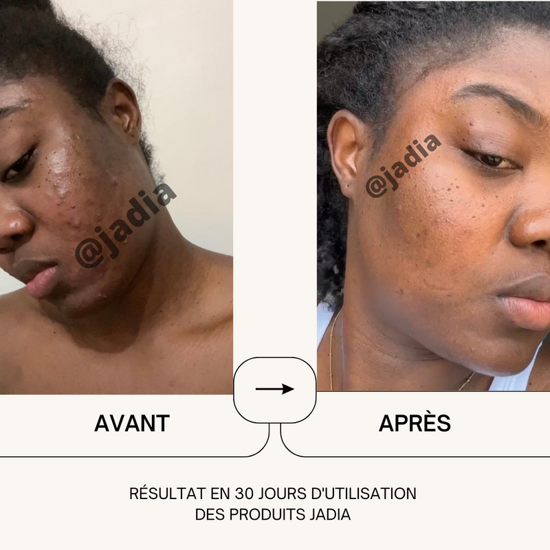 LES PACKS JADIA© – JADIA SKIN & BEAUTY